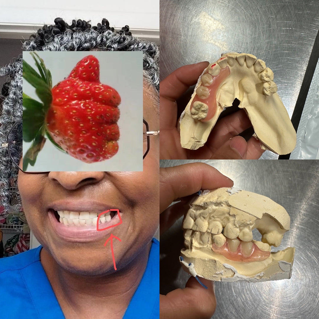 Permanently Flexible/TCS partial denture *Impression kit included ...