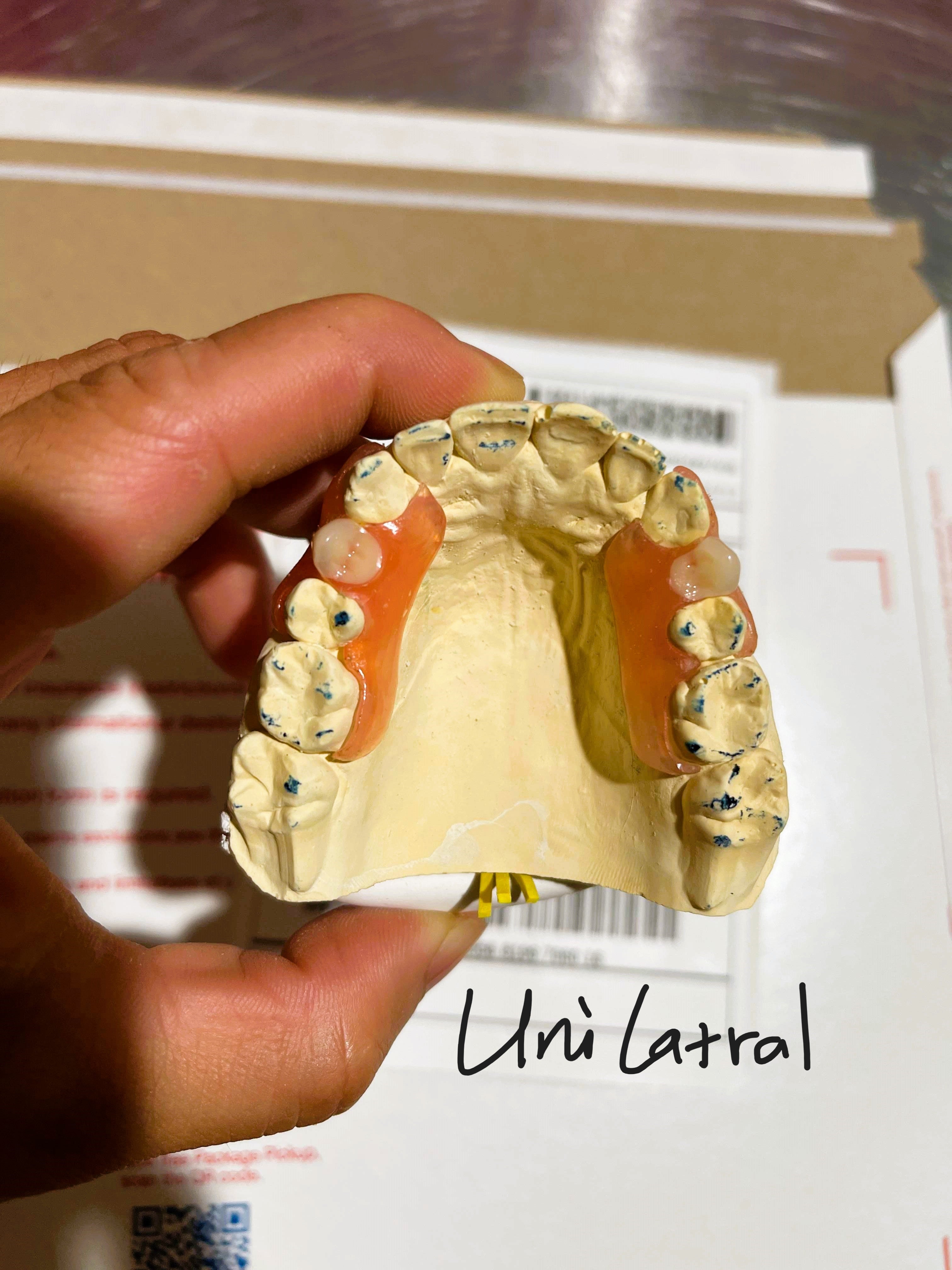 Permanently Flexible/TCS partial denture *Impression kit not included ...
