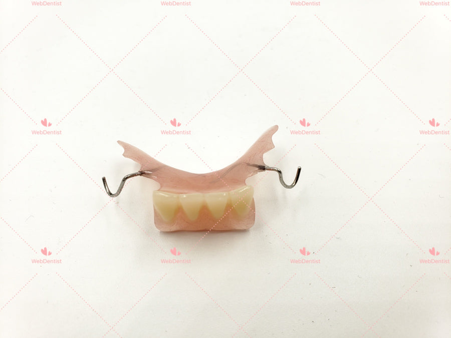 Flipper/Stayplate Partial Denture (acrylic material) *Impression kit I ...