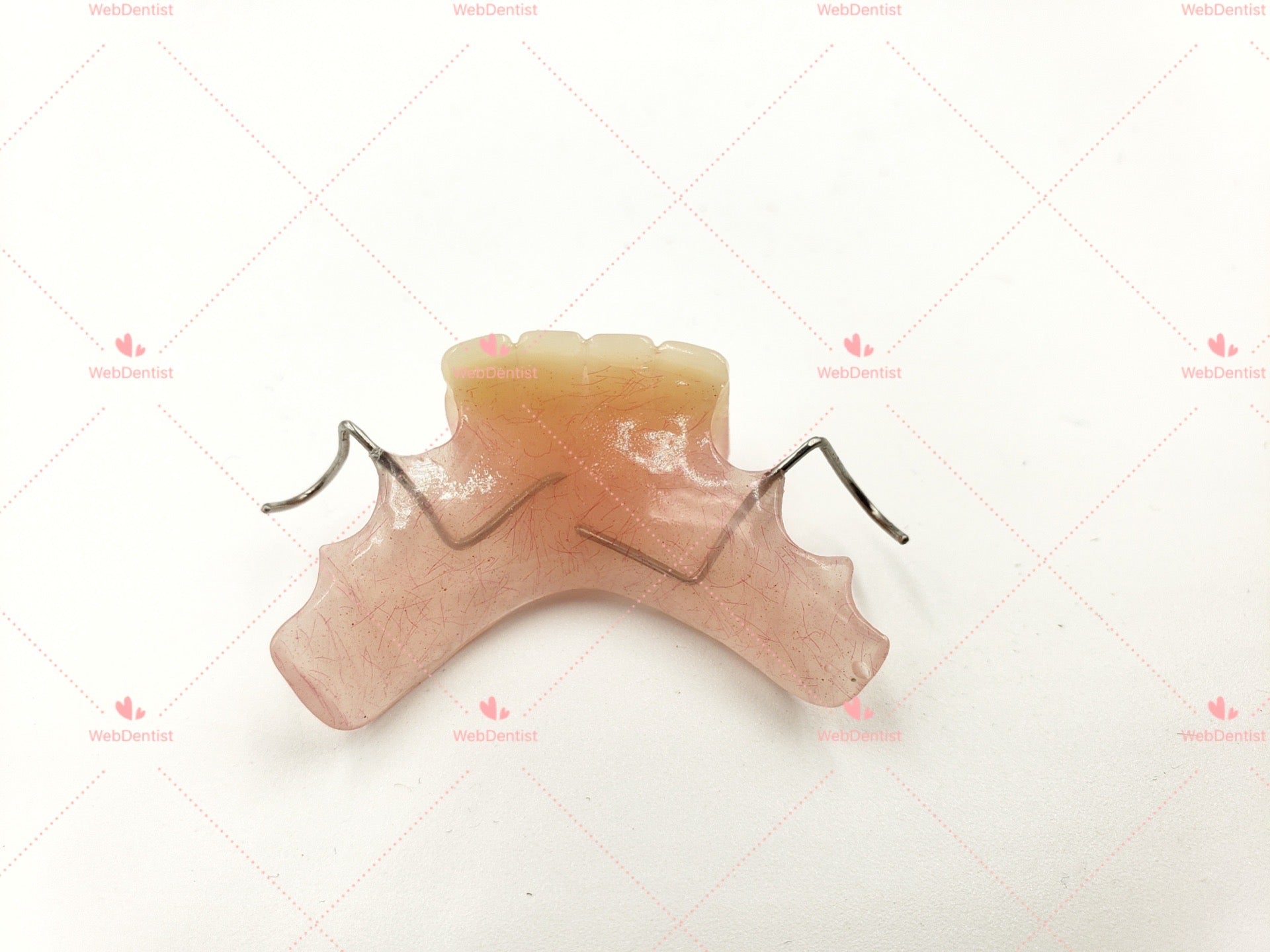 Flipper/Stayplate Partial Denture (acrylic material) *Impression kit I ...