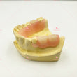Permanently Flexible/TCS partial denture *Impression kit not included ...