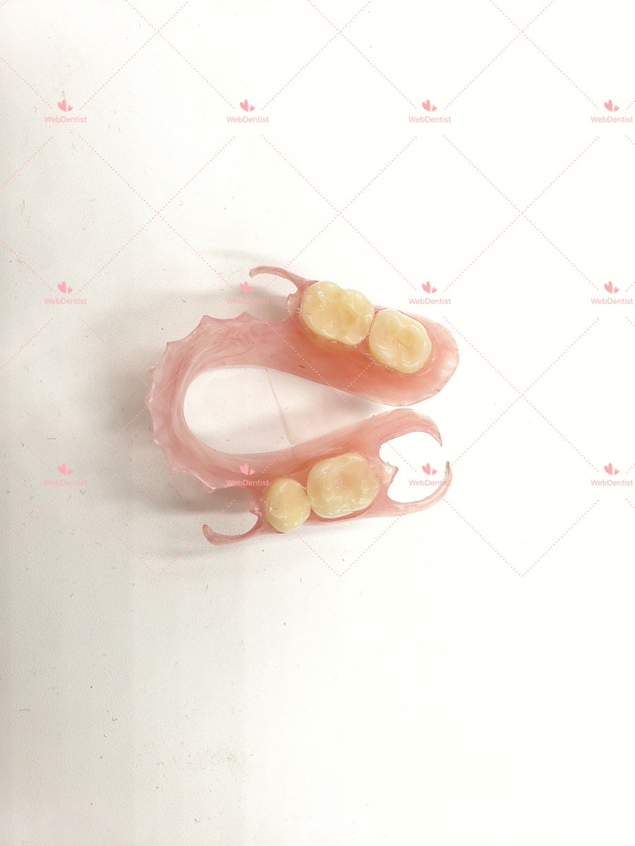 Permanently Flexible/TCS partial denture *Impression kit included ...