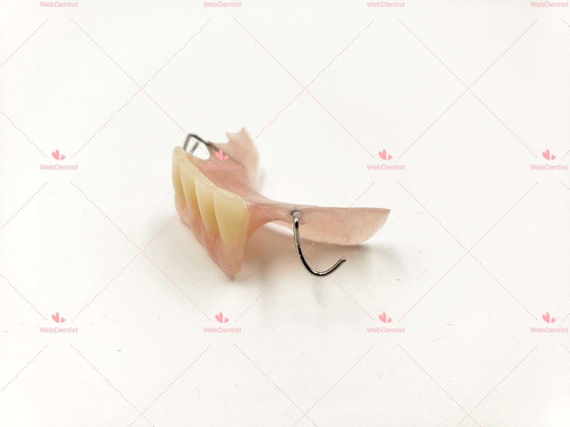 Flipper/Stayplate Partial Denture (acrylic material) *Impression kit I ...